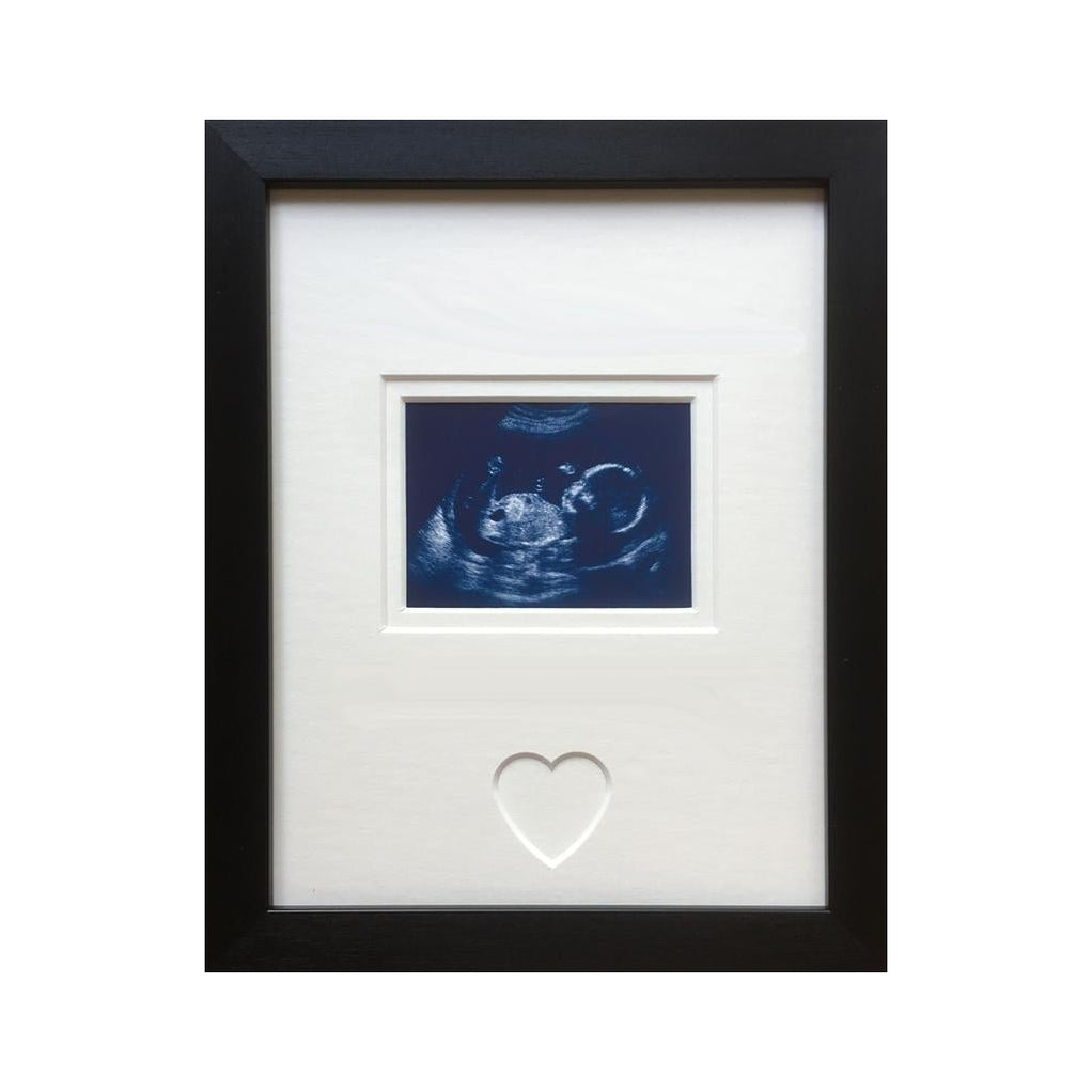 Custom First Scan Picture Frame | Azana Photo Frames