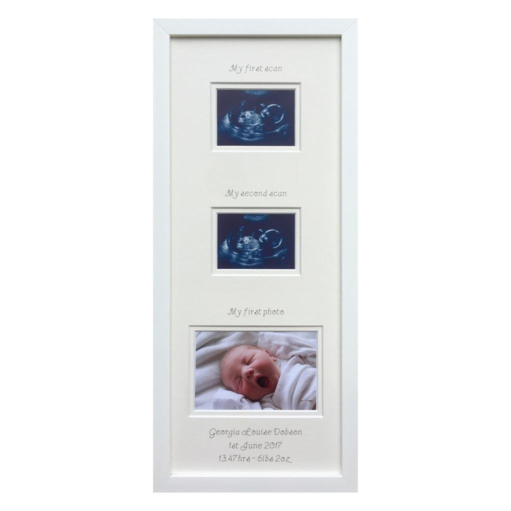 Pregnancy Scan Picture Gifts | Azana Photo Frames