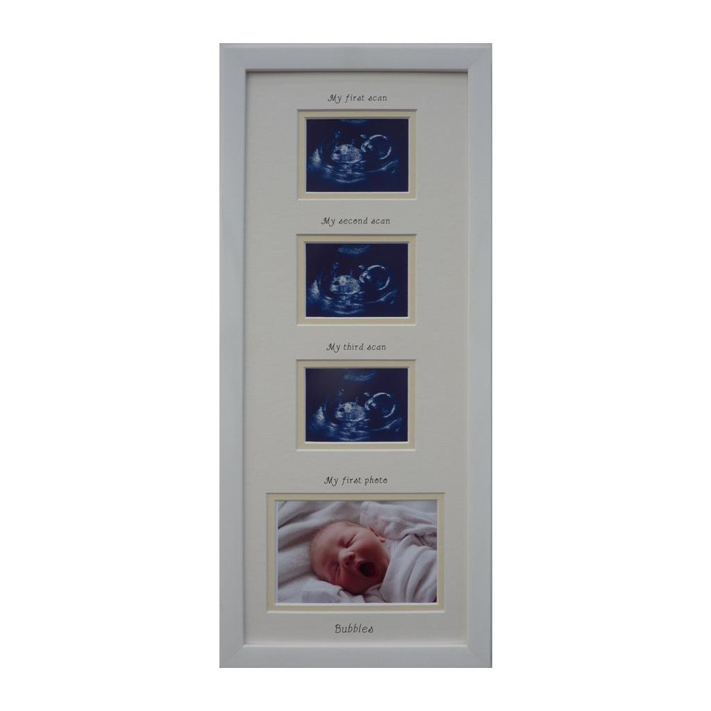 Unisex Triple Scan Picture Gift | New Baby | Azana Photo Frames